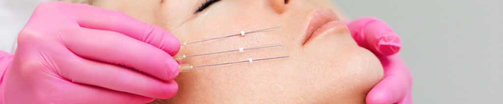 Lifting Threads Sugar Land - Non-Surgical Face Lift Richmond, TX.